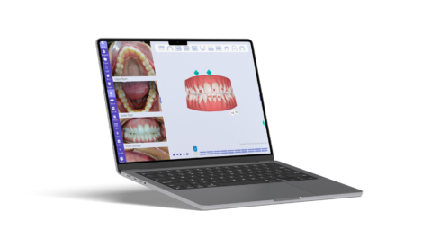 Pro Aligner - Prodonto